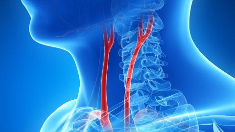 Ultraschall Halsschlagader - Praxis Dr med Georg Thielen und Kollegen